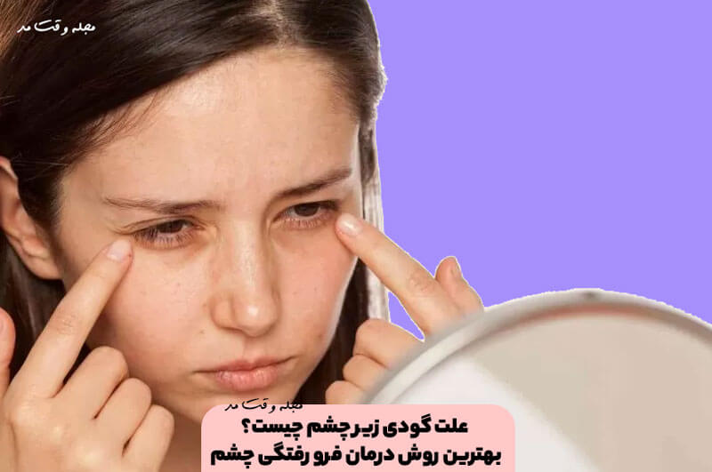 علت گودی زیر چشم چیست؟ بهترین روش درمان فرو رفتگی چشم